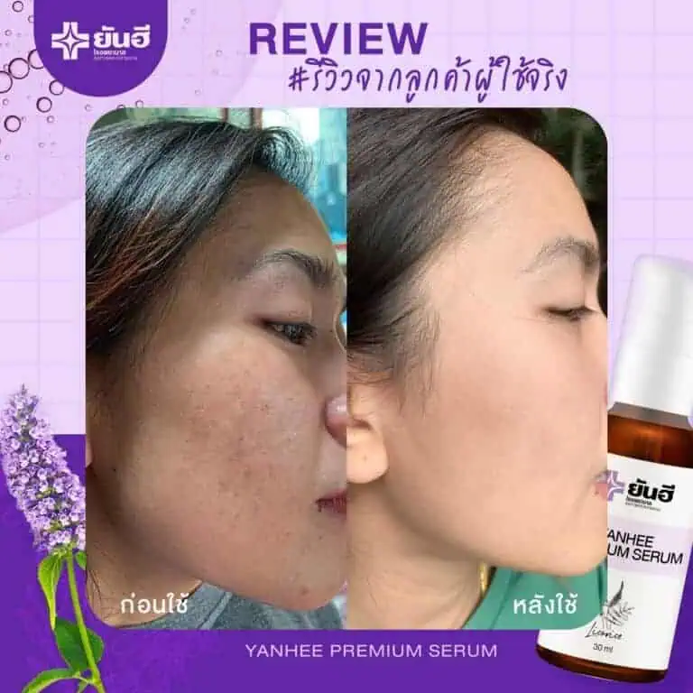 Yanhee Premium Serum review | Yanhee Thailand Online