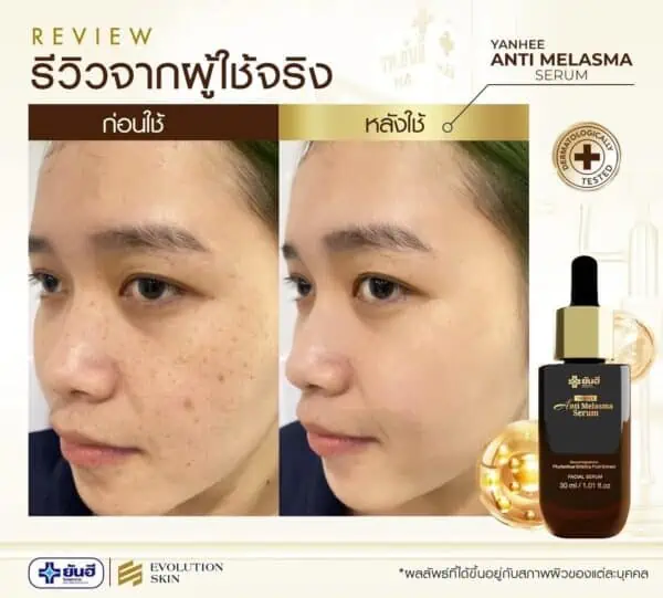 Yanhee Anti Melasma Serum ยันฮี แอนตี้ เมลาสม่า ซีรั่ม | Yanhee ...