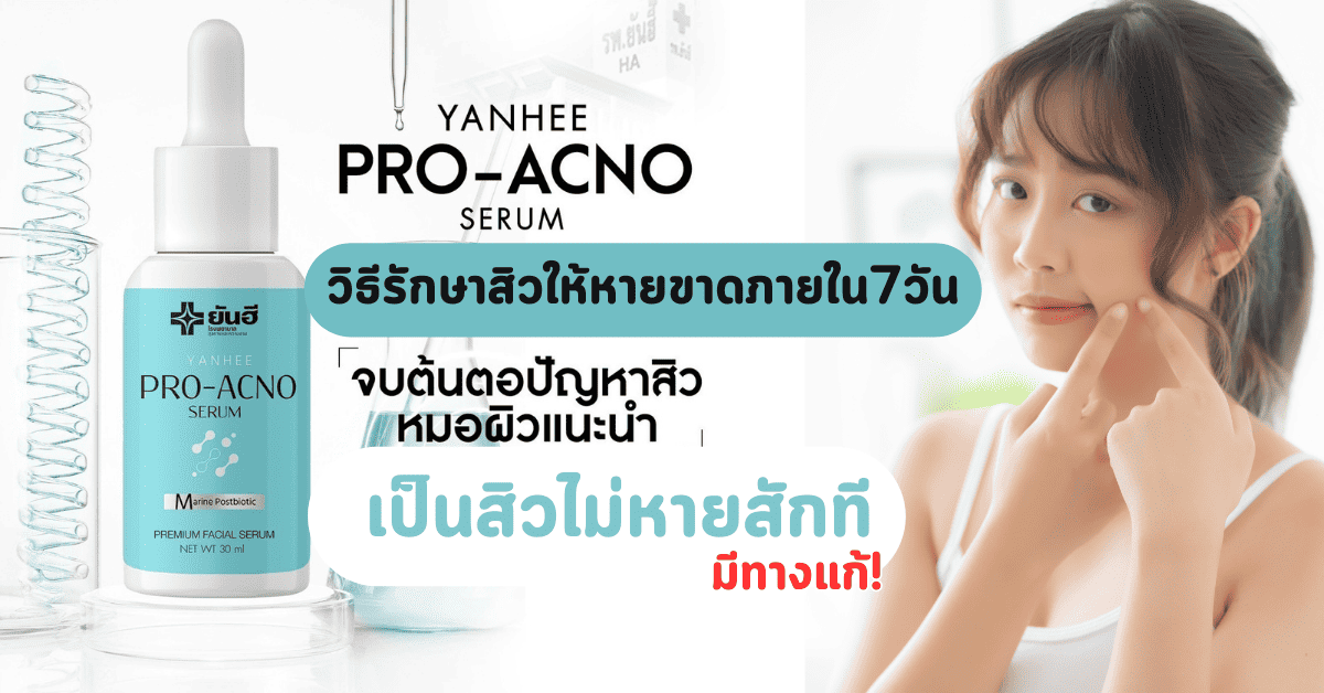 วิธีรักษาสิวให้หายขาดภายใน 7 วัน เป็นสิวไม่หายสักที มีทางแก้ | Yanhee ...